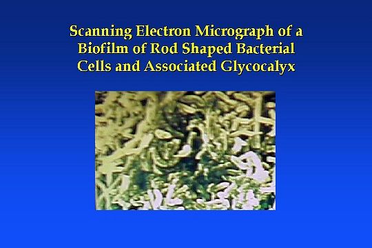 Dialysis Devices: A Photographic History of Progress | RPC-Rabrenco