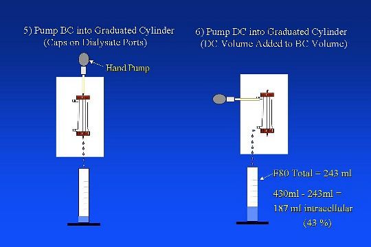 Dialysis Devices: A Photographic History of Progress | RPC-Rabrenco